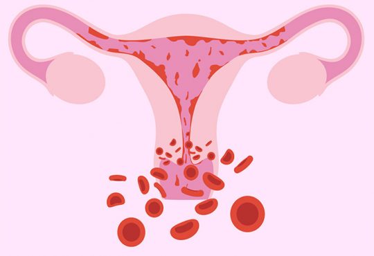 Rong Kinh Là Gì? Nguyên Nhân, Triệu Chứng Và Cách Khắc Phục