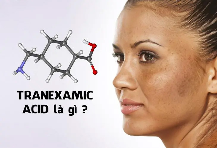Tranexamic Acid Là Gì, Có Tác Dụng Thế Nào Trên Da?