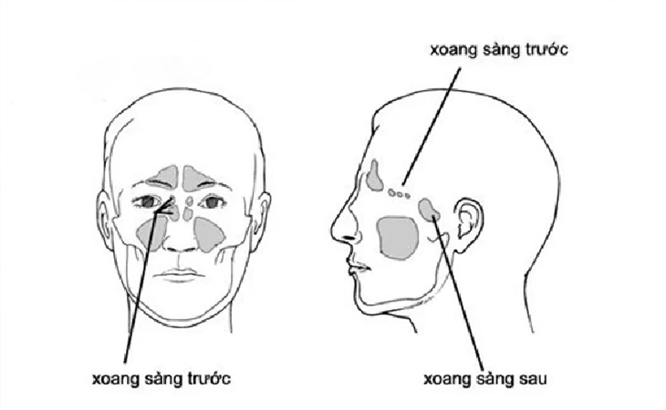Viêm Xoang Sàng Sau: Triệu Chứng, Nguyên Nhân, Cách Điều Trị