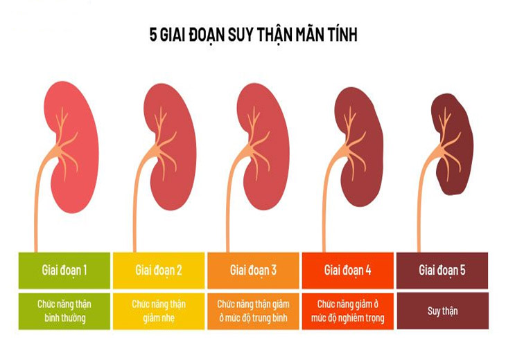 Suy Thận Nhẹ Có Chữa Được Không? Các Dấu Hiệu Nhận Biết
